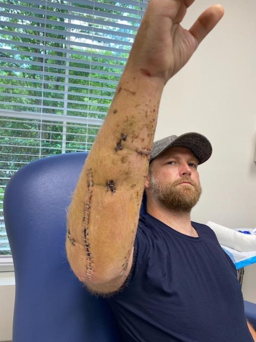 A Charleston Fossil Hunter Survived a Brutal Alligator Attack—and Plans ...